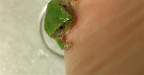 Behold A Frog Album On Imgur