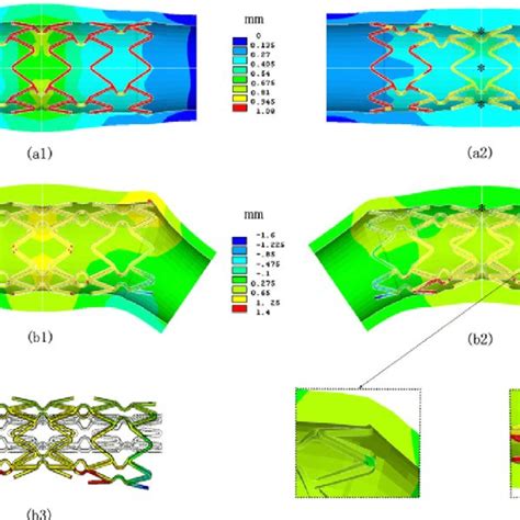 Pdf Stent Expansion In Curved Vessel And Their Interactions A Finite Element Analysis