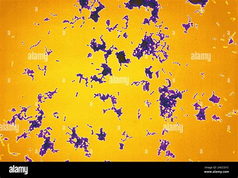Streptococcus Mutans Bacteria Coloured Digitised Light Micrograph Of Clusters Of Streptococcus