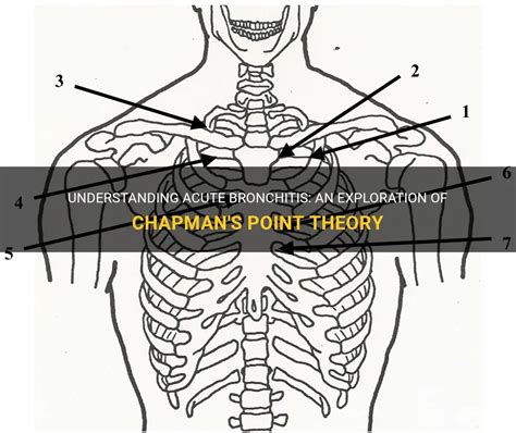 Understanding Acute Bronchitis An Exploration Of Chapmans Point Theory Medshun
