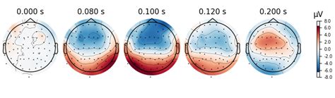 overview of meg eeg analysis with mne python — mne 1 8 0 documentation