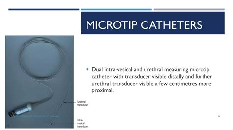 Urodynamics Pdf Digestive Disorders Diseases And Conditions