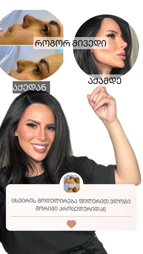 Merci Mertsia Sulkhanishvili ვერ მოვითმინე 😅 ხშირად გოგოები კითხულობთ ვინ აკეთებს საუკეთესო
