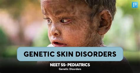 An Overview Of Genetic Skin Disorders Prepladder