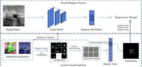 논문 리뷰 Lce A Framework For Explainability Of Dnns For Ultrasound Image Based On Concept Discovery