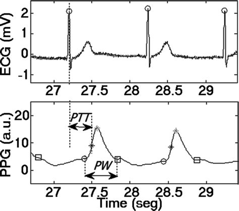 Ecg And Ppg Signal With Ptt And Pw Representation [70] Download Scientific Diagram