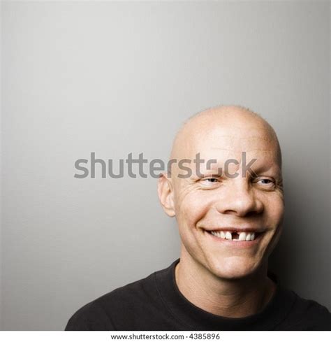 Portrait Midadult Caucasian Male Missing Tooth Stock Photo Shutterstock