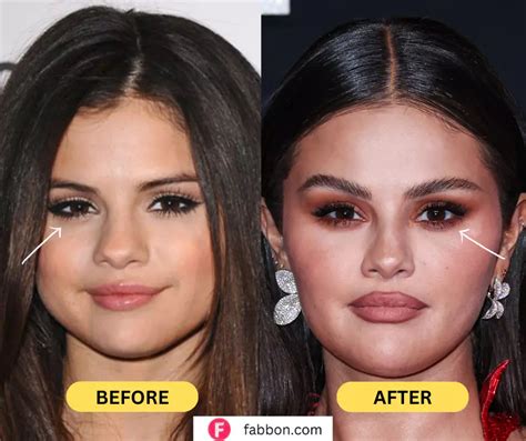 Did Selena Gomez Get Plastic Surgery Fabbon