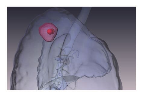 3d Visualization Of Patient Cases With Spatial Mismatch And Match Download Scientific Diagram