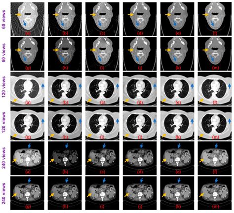 Degradation Aware Deep Learning Framework For Sparse View Ct