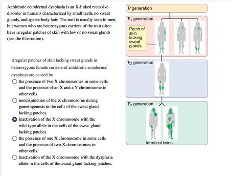 Solved Chapter 4 Homework Anhidrotic Ectodermal Dysplasia