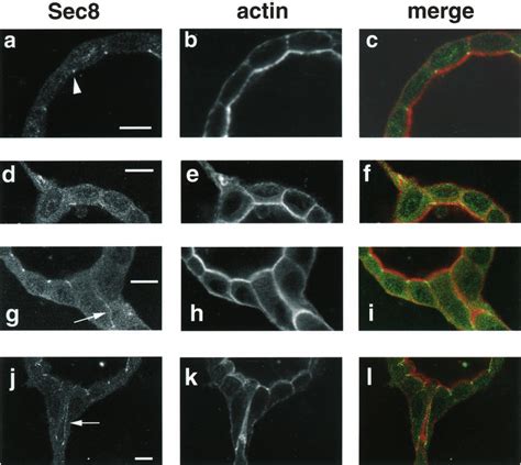 Sec8p Relocalizes During Tubulogenesis A And B Fluid Filled Cyst