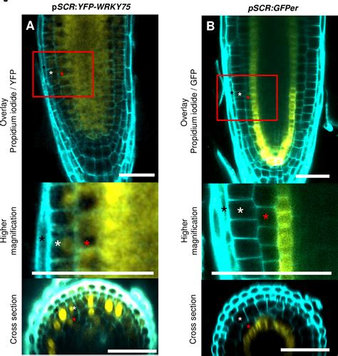 Figure 1 From Non Cell Autonomous Regulation Of Root Hair Patterning Genes By Wrky75 In
