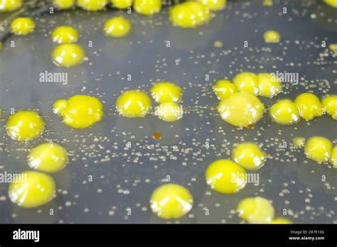 Bacteria Grown From Skin Smear Colonies Of Micrococcus Luteus And Staphylococcus Epidermidis On