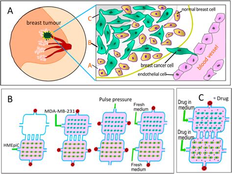 Microfluidic Tumor On Chip Systems For Breast Cancer Research Microfluidics Innovation Center