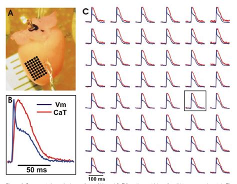 Figure 1 From Optical Mapping Of Action Potentials And Calcium