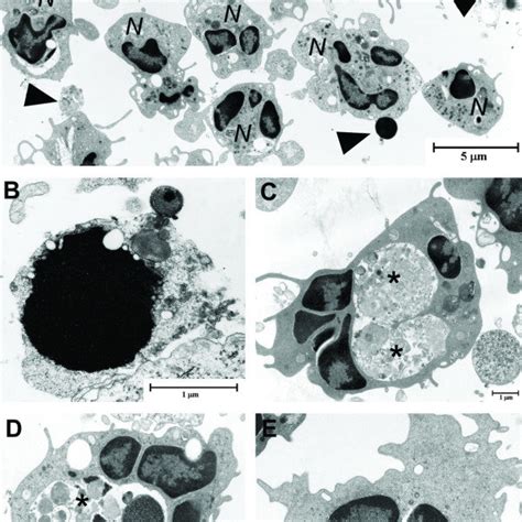 Representative Transmission Electron Micrographs Displaying Neutrophils Download Scientific
