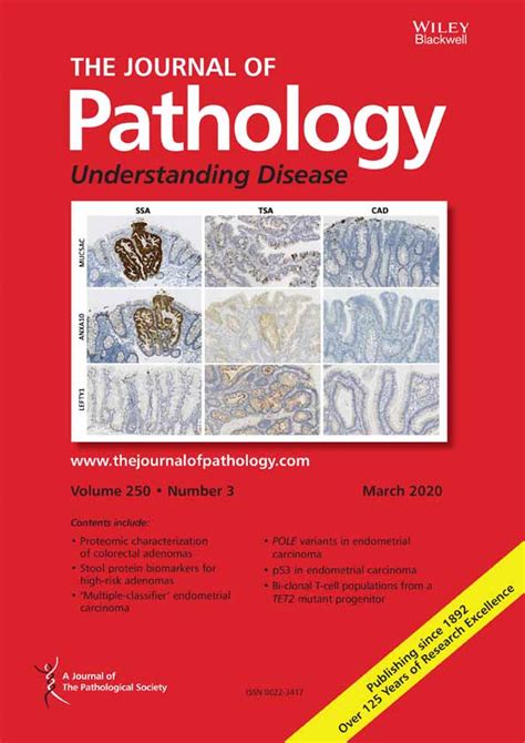 P53 Immunohistochemistry Is An Accurate Surrogate For Tp53 Mutational Analysis In Endometrial