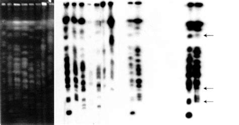Chromosomal Localization Of Telomere Associated Sequences