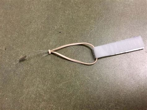 Dynamic Extension Splinting The Ultimate Guide OTFocus