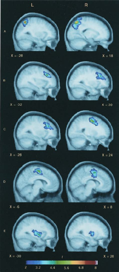Brain Activity Common To Both Spatial Memory And Nonspatial Strategy