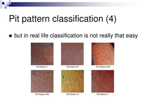 Ppt Pit Pattern Classification In Colonoscopy Powerpoint Presentation