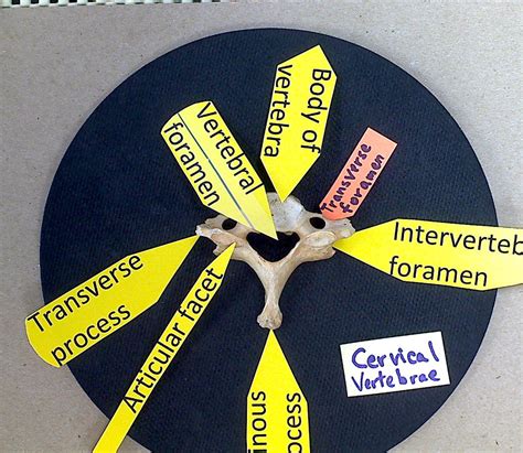 Unit 7 Axial Skeleton Stagg High Babe Anatomy Physiology