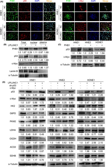 Lplunc1 Or Phb1 Overexpression Modulates P53 And C‐myc Expression And Download Scientific