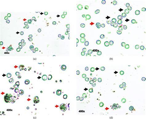 Dna Fragmentation Detected Using An Apoptosis Detection Tunel Kit