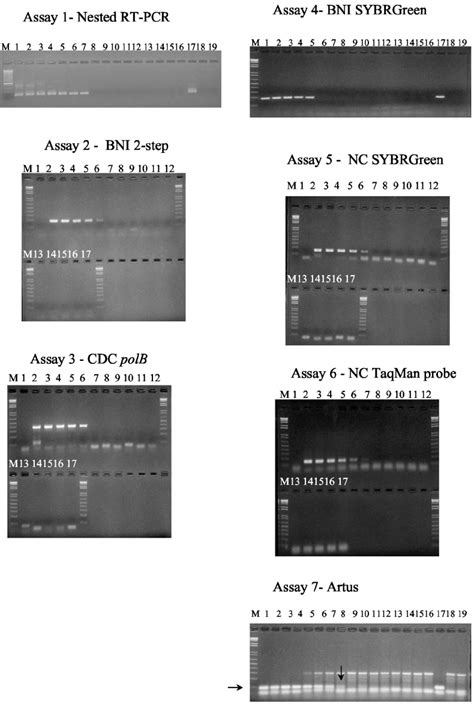 Analysis Of Ampli Fi Cation Products Of Seven Rt Pcr Assays For