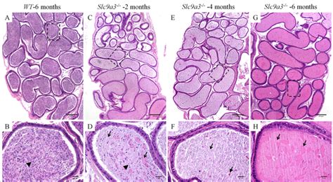 Efferent Ductules Histology