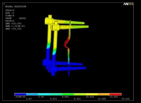Deformation Diagram Of The Pedicle And Posterior Longitudinal Ligament Download Scientific