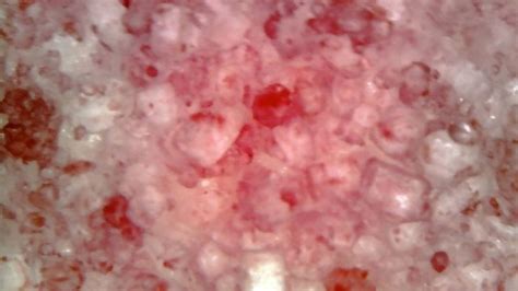 Devouring Haribo Chamallows Ruby With Microcamera In Mouth Happy