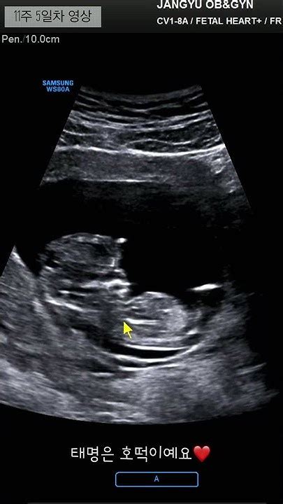 아기천사가 찾아왔어요👼🏻 Youtube