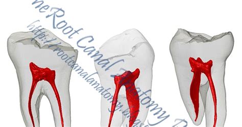 The Root Canal Anatomy Project Mandibular Second Molar