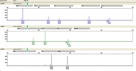 Results Of Str Analysis Str Results Indicate That Cell Samples Were Download Scientific