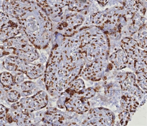 Double Stranded Dna Dsdna Nuclear Marker Recombinant Monoclonal Antibody Dsd 8204r Rbm7