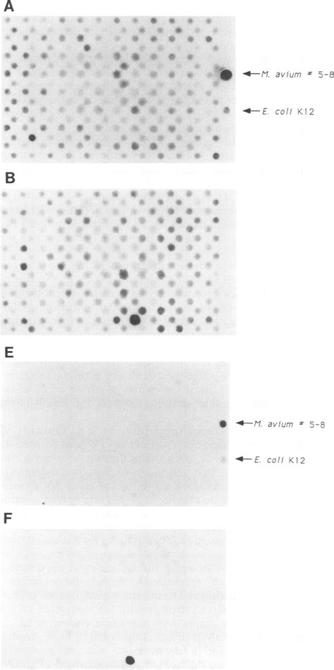 Subtracted Cdna Was Pcr Amplified Labeled With Digoxigenin And