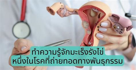 ทำความรู้จักมะเร็งรังไข่ หนึ่งในโรคที่ถ่ายทอดทางพันธุกรรม Feidathai