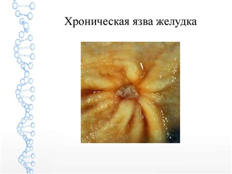 Патология желудка - презентация онлайн