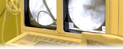 Операция и след това Д р Георги Васев