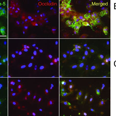 Exogenous Glucuronoxylomannan Gxm Administration And Cryptococcus Download Scientific Diagram