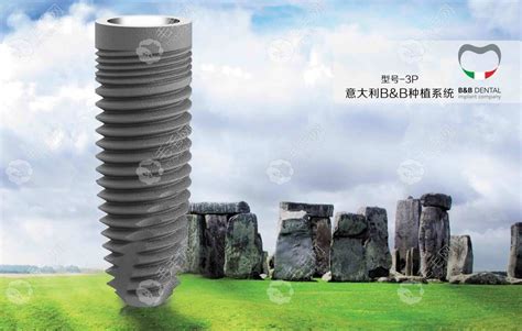 意大利bb种植体优势 意大利bb种植体价位 意大利bb种植体的优缺点 毛毛网