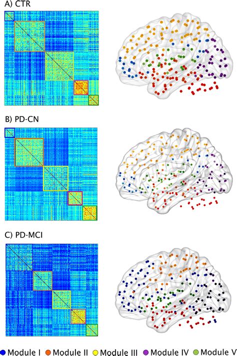 Functional Brain Networks And Modules In Controls And Pd Mci Patients