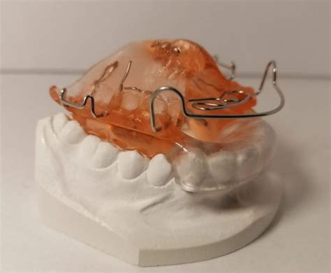 Half Open Activator Braces For Fun