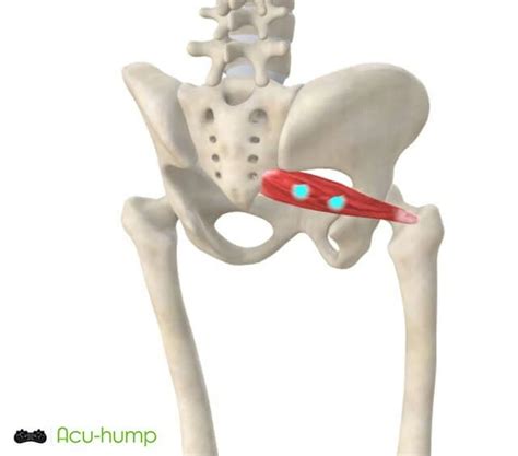 6 Ways To Release Trigger Points For Piriformis Syndrome