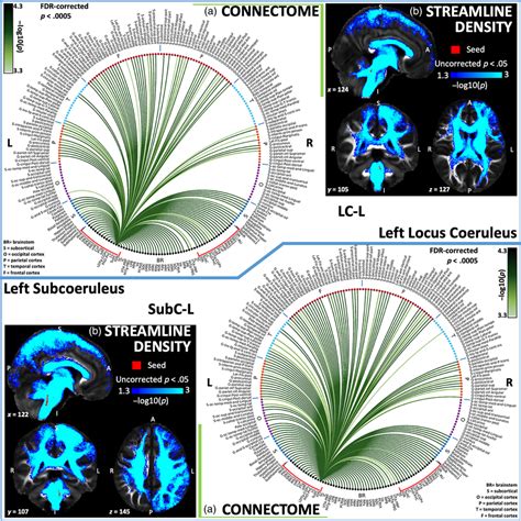 Structural Connectivity Results Of Locus Coeruleus—lc Top And