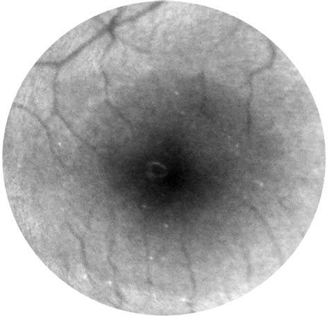 What We Do Profundus