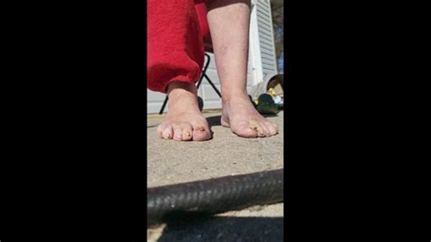 Meet My Fungus Feet Year Old Tits And Nails Clips Sale