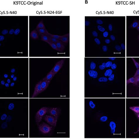 Confocal Microscopy Of Internalized Elp Constructs Merged Dapi Blue